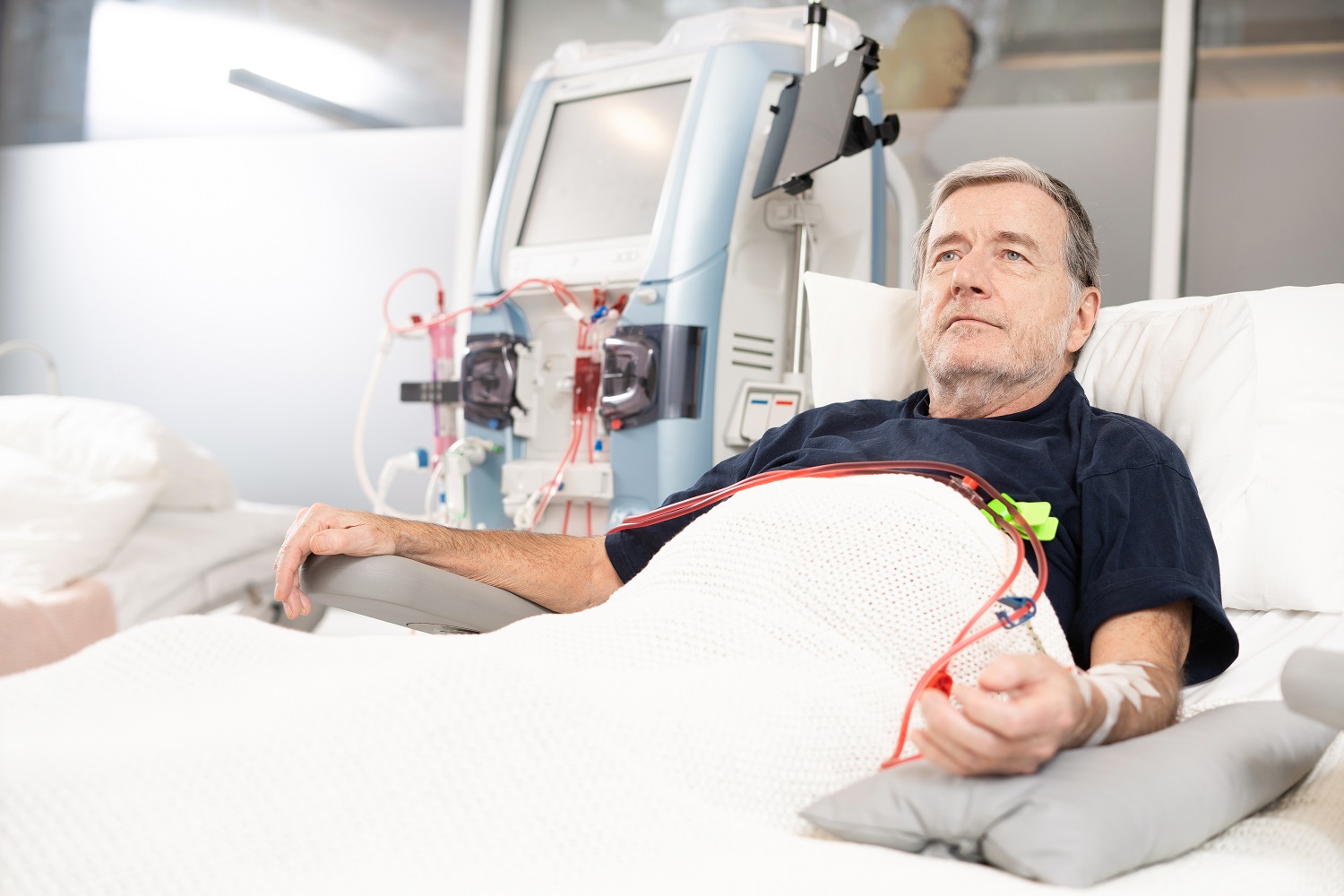 Haemodialysis: the process